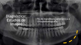 Fracturas de mandibula.pptx