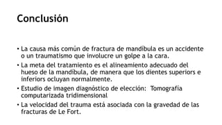 Fracturas de mandibula.pptx