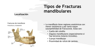 Fracturas de mandibula.pptx