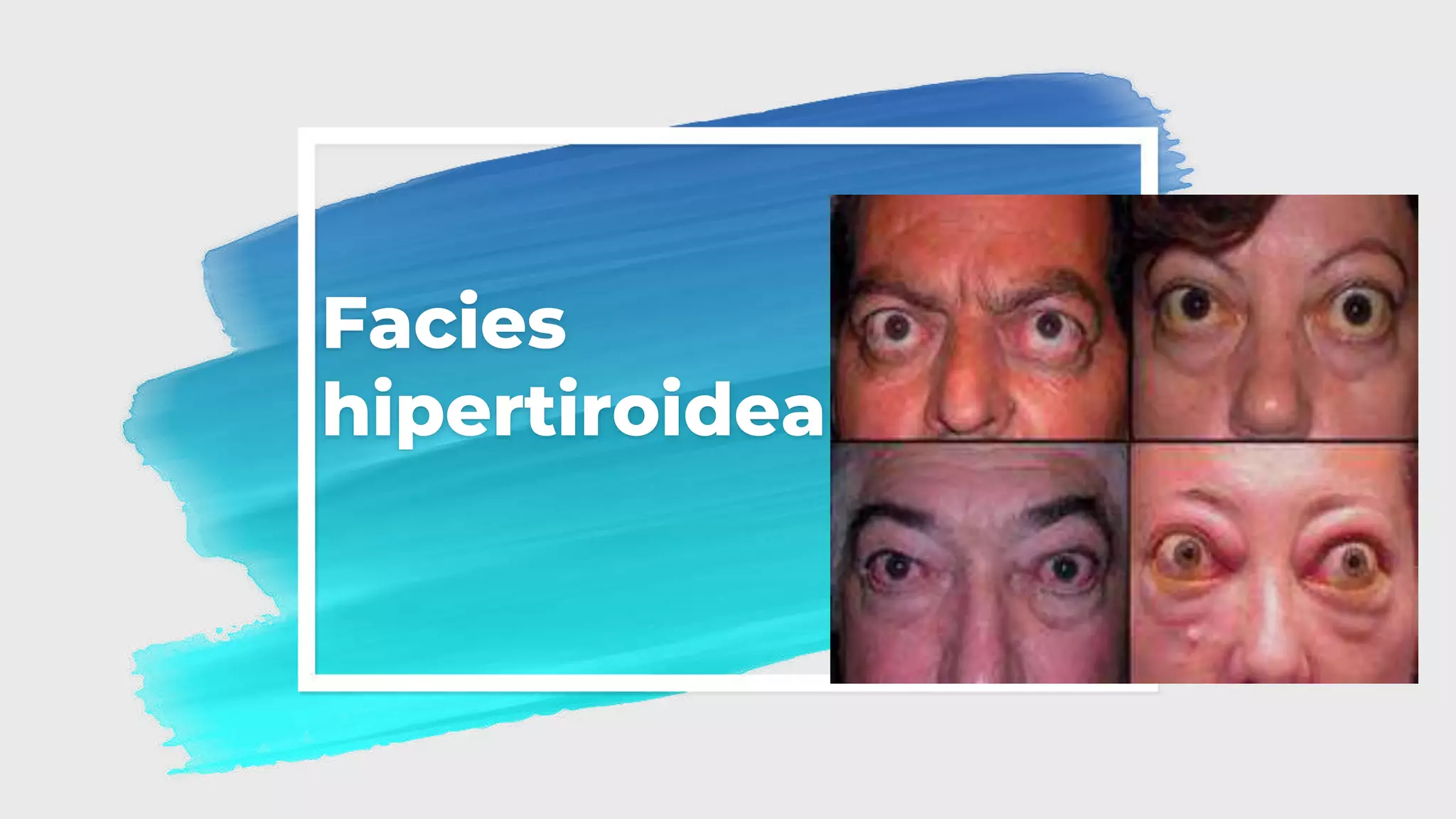 Facies | PPTX
