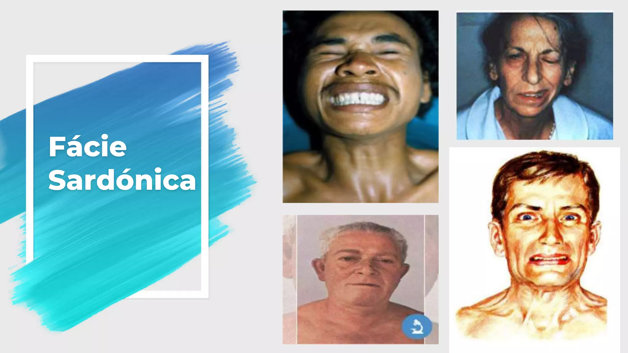 Facies | PPTX
