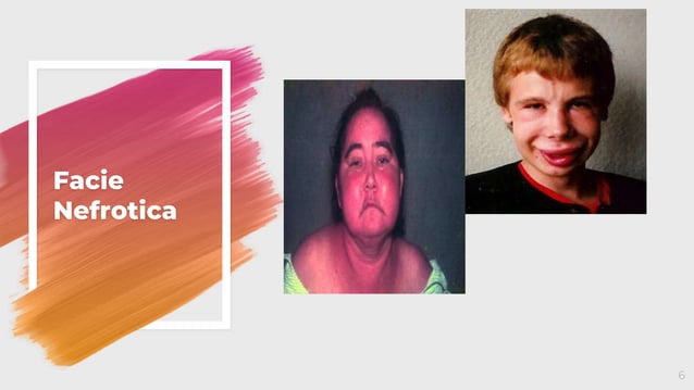 Facies | PPTX