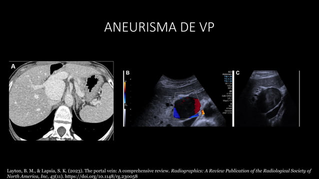 La vena porta patologia. .pptx