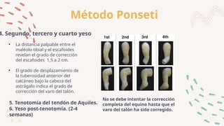 Copia de Método Ponseti, pie equino varo.pptx