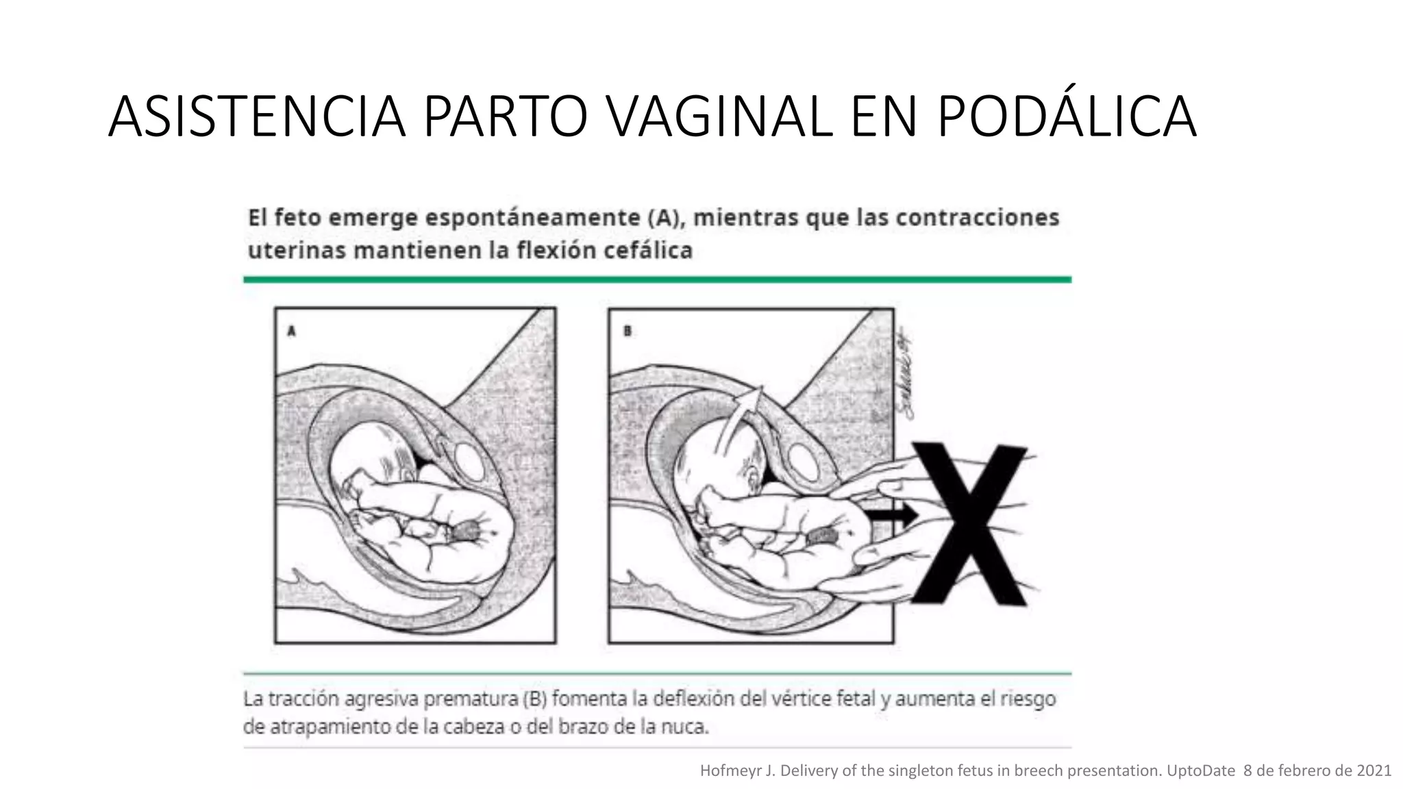 PARTO EN PODÁLICA.pptx