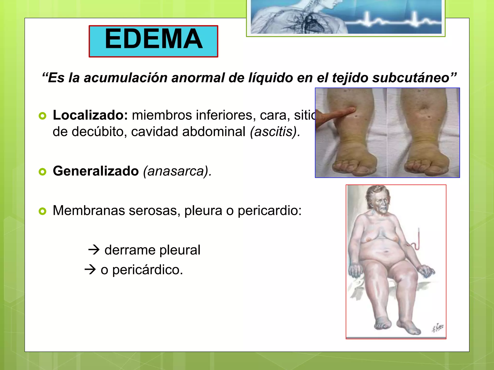 SEMIOLOGÍA DE LOS PRINCIPALES SIGNOS Y SÍNTOMAS DE ENFERMEDAD ...
