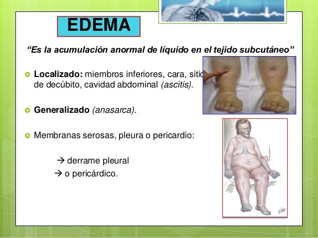 SEMIOLOGÍA DE LOS PRINCIPALES SIGNOS Y SÍNTOMAS DE ENFERMEDAD CARDIOV…