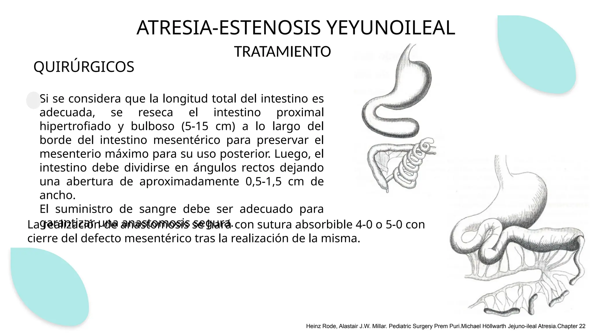 ATRESIA intestinal patología de paciente | PPTX