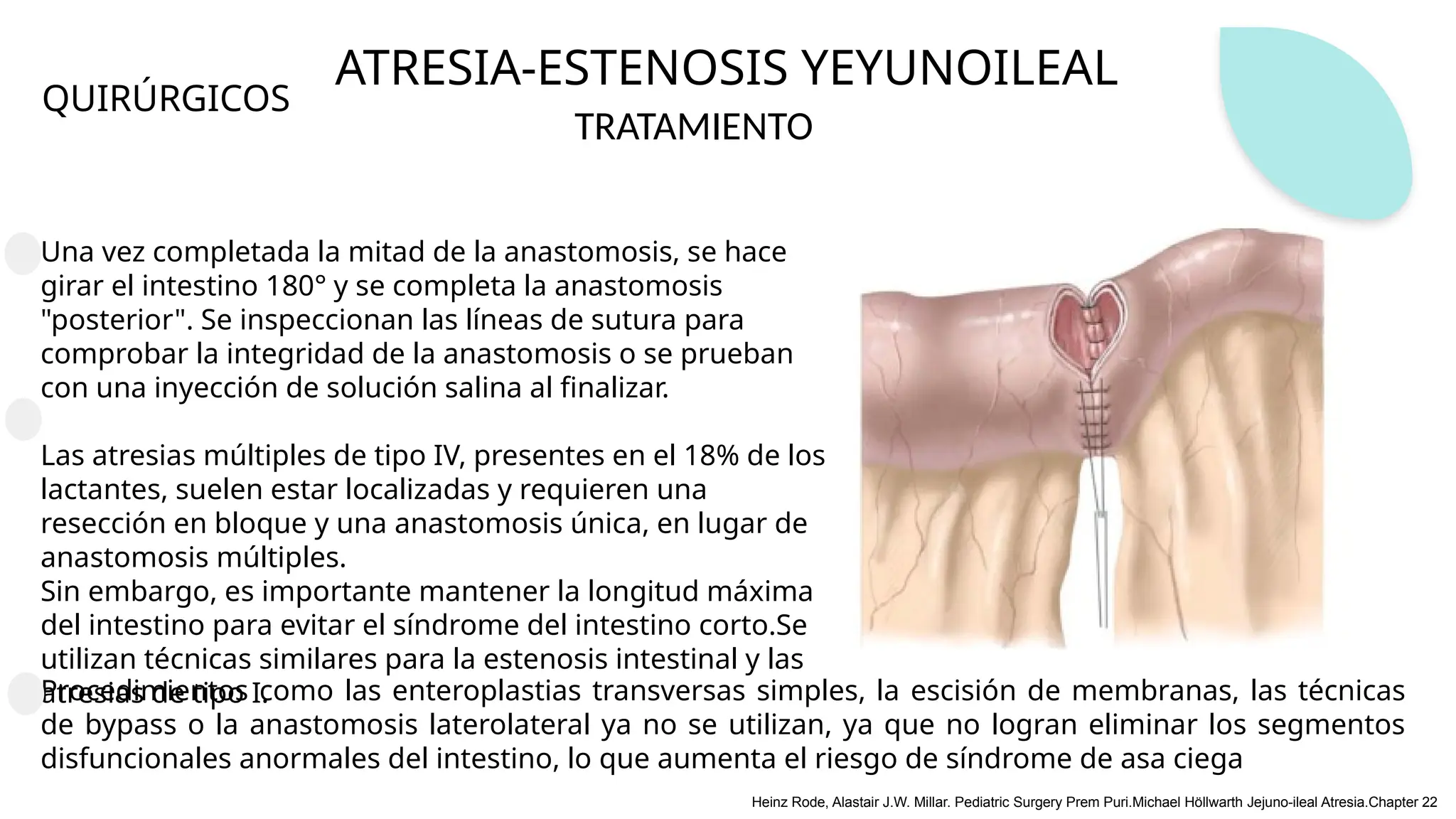 ATRESIA intestinal patología de paciente | PPTX
