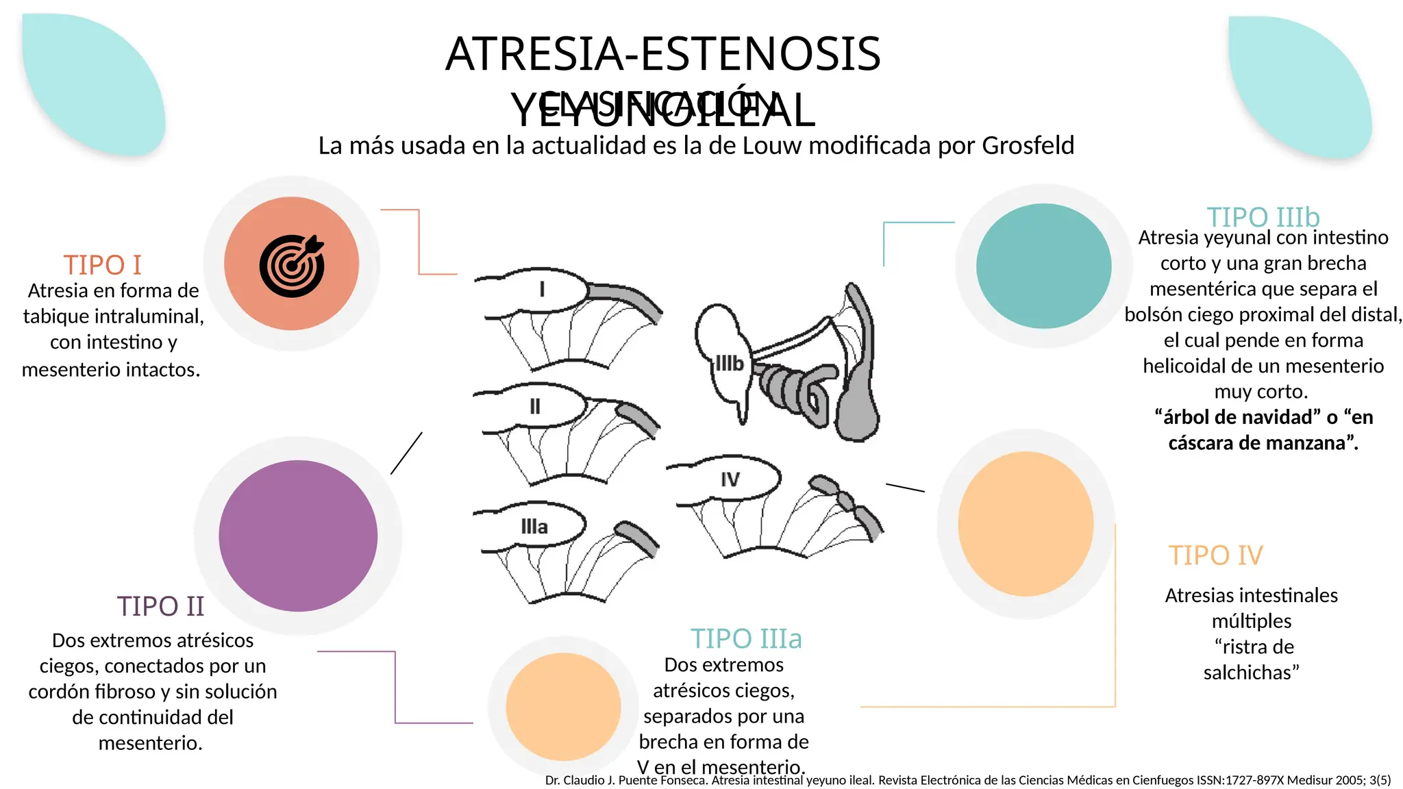 ATRESIA intestinal patología de paciente | PPTX