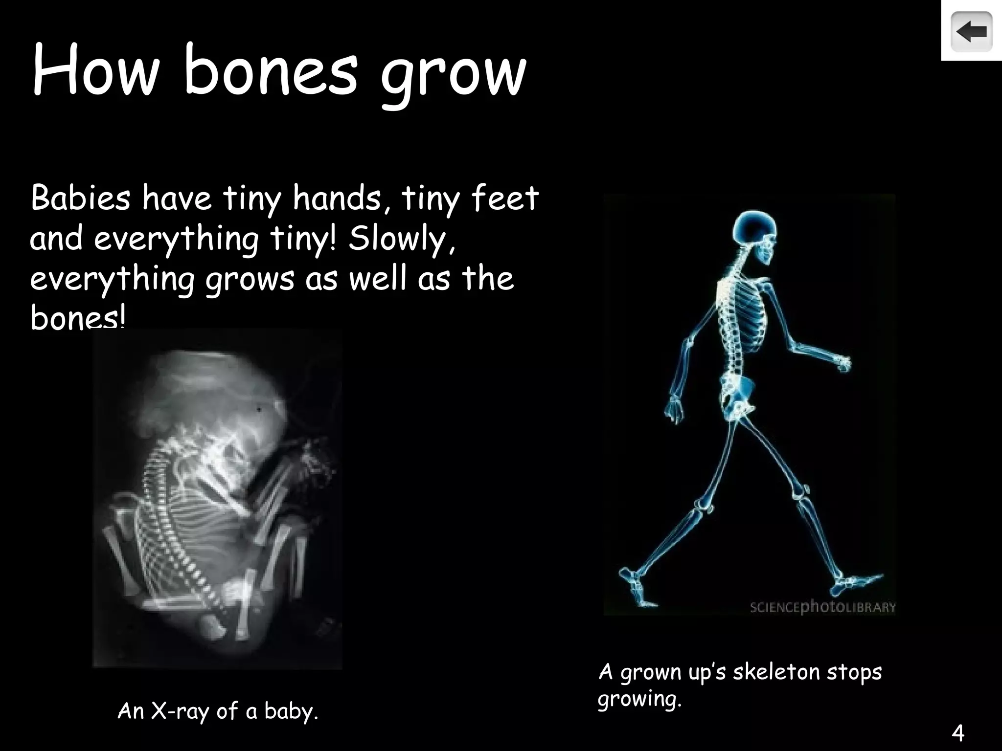 Skeleton and bones | PPT