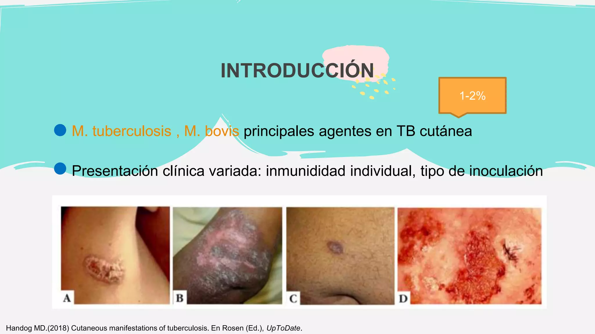 Tuberculosis Cutanea