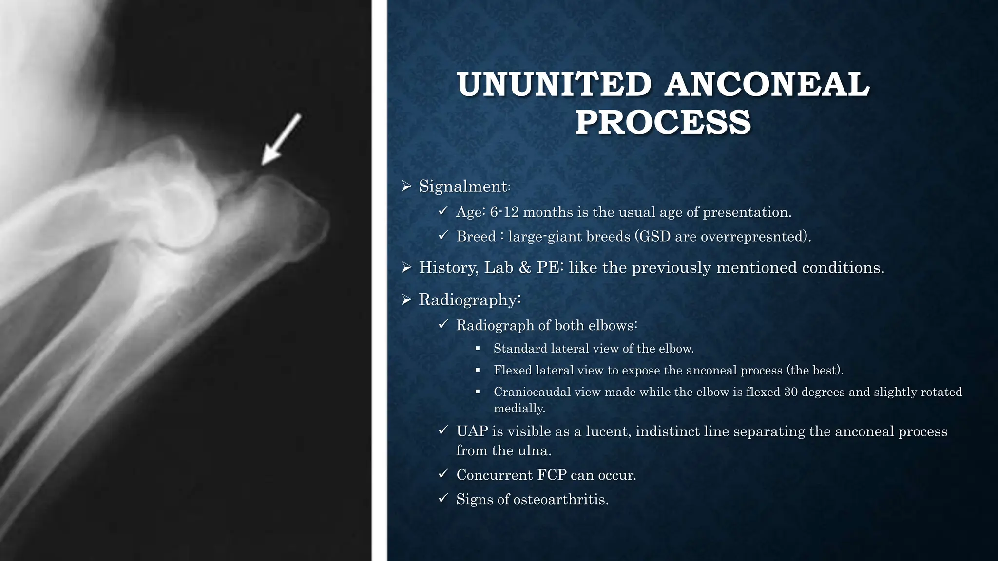 Copie de Elbow dislocation and dysplasia.pptx