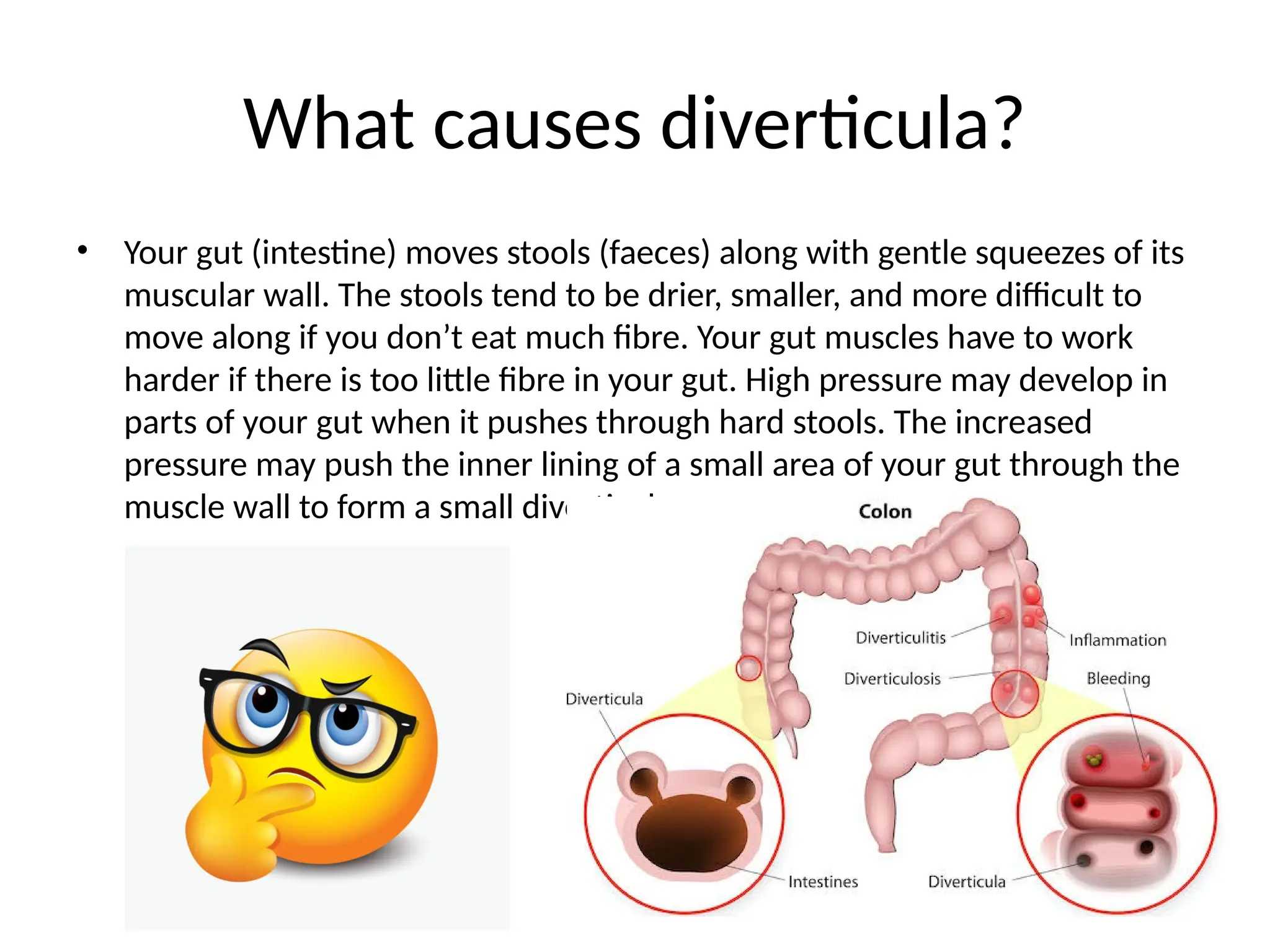 Coping with Diverticulitis of the Human Body | PPTX