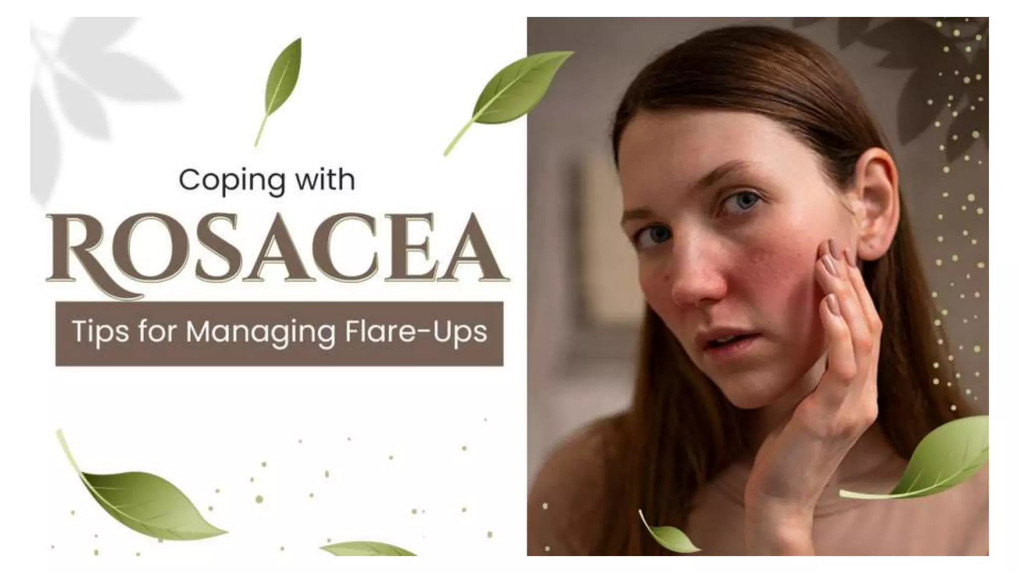 Coping with Rosacea Tips for Managing Flare - Ups | PPT