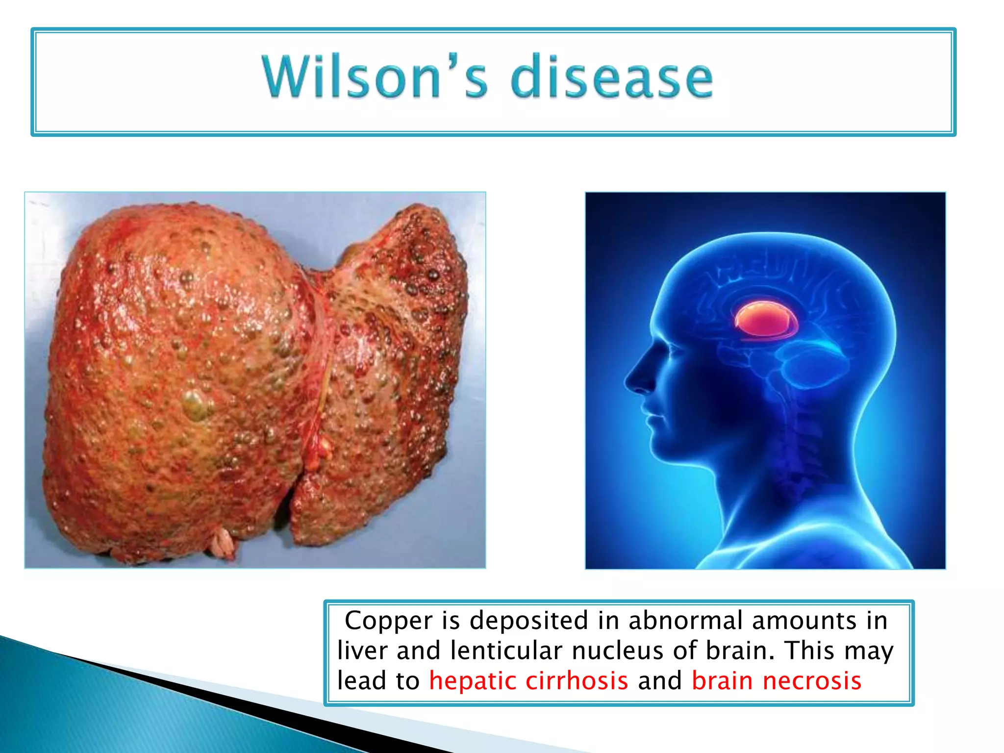 Copper clinical importance for medical students | PPTX