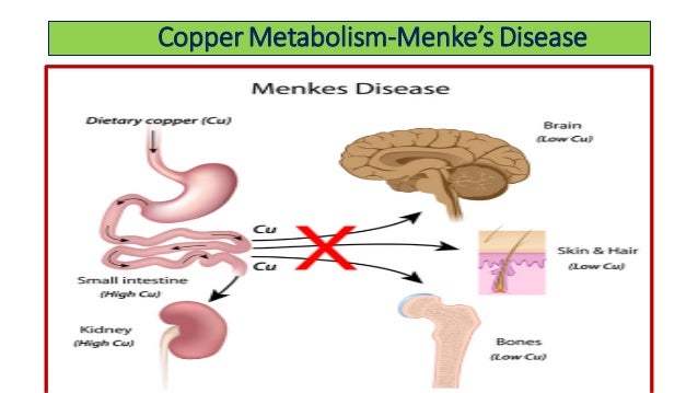 Copper metabolism and its clinical significance