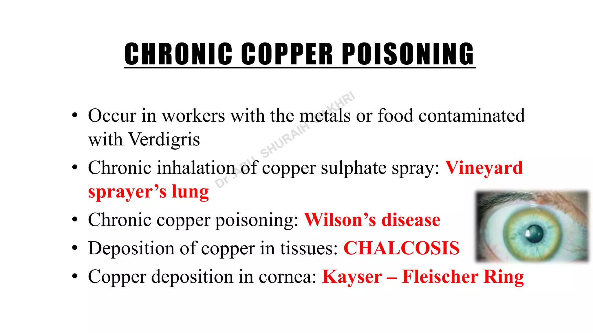 Copper poisoning | PPTX