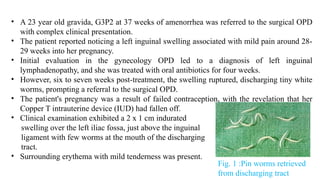 Mistaken calcified worm to copper T : An unusual case report | PPT