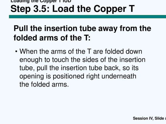 Copper T insertion | PPT