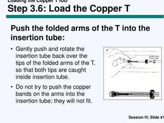 Copper T insertion | PPT