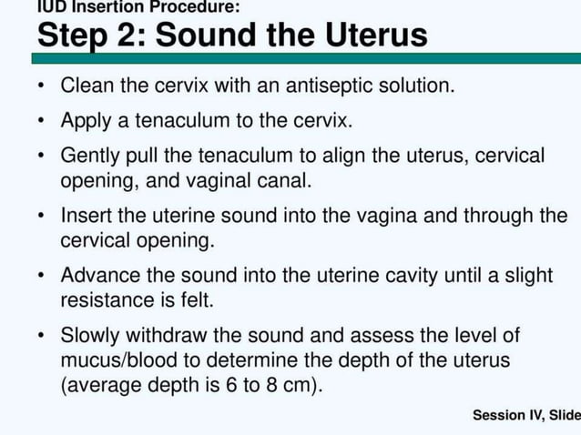 Copper T insertion | PPT