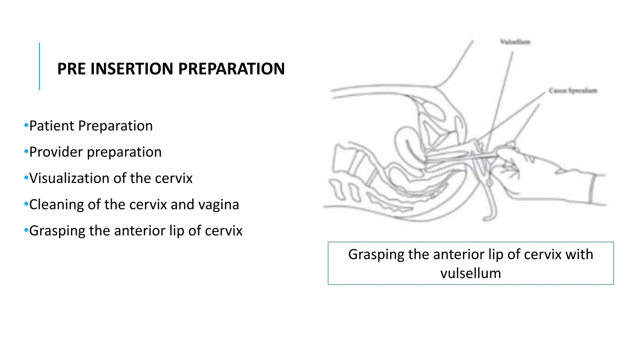 copper t presentation - insertion and removal.pptx
