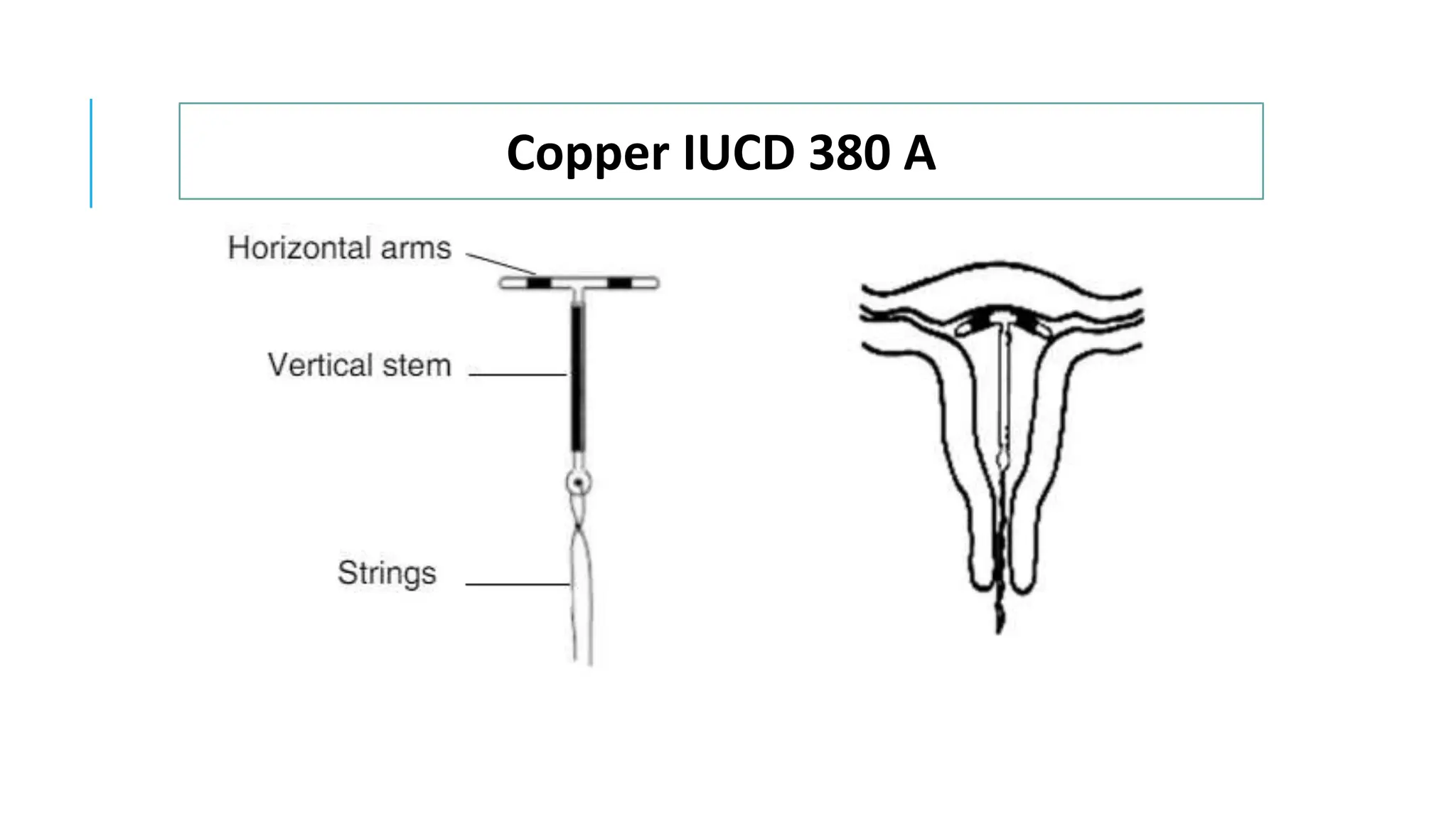 copper t presentation - insertion and removal.pptx