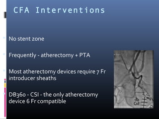 Coppola J - AIMRADIAL 2014 Endovascular - Iliac and femoral | PPT