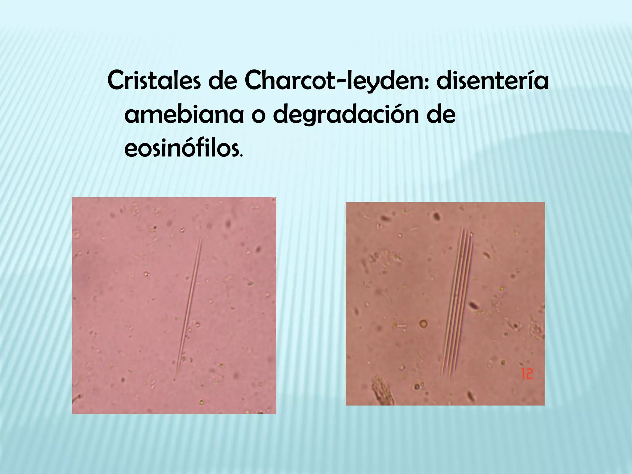 Coprología examen de heces | PPT