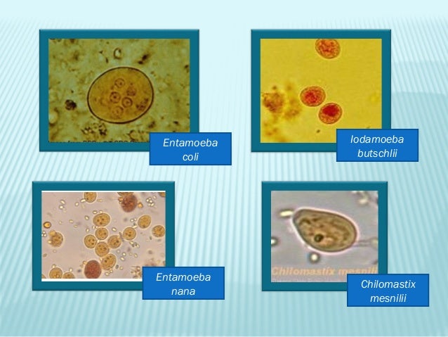 Coprología examen de heces