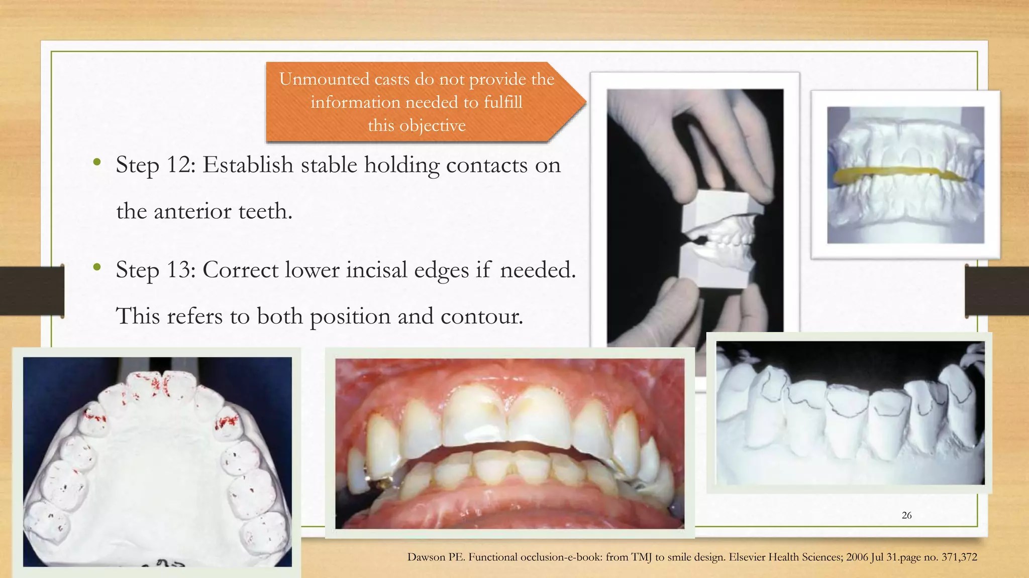 full mouth rehabilitation part 1 | PPTX