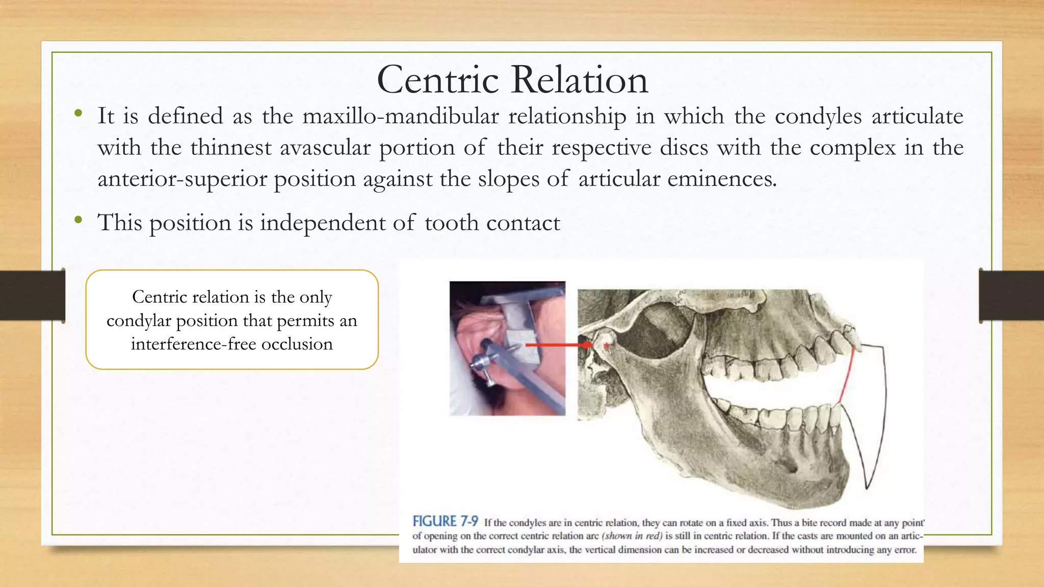 full mouth rehabilitation part 1 | PPTX