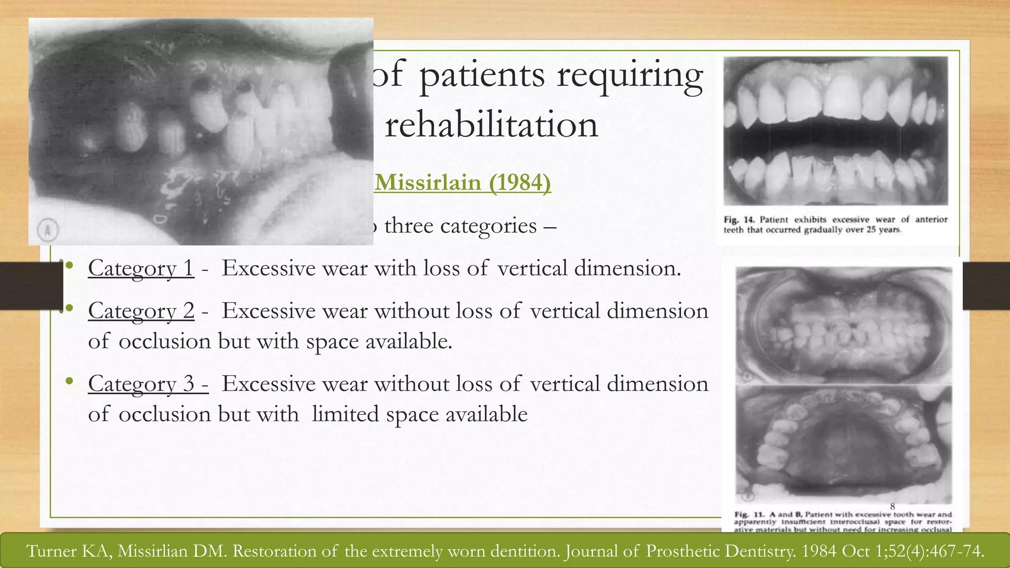 full mouth rehabilitation part 1 | PPTX