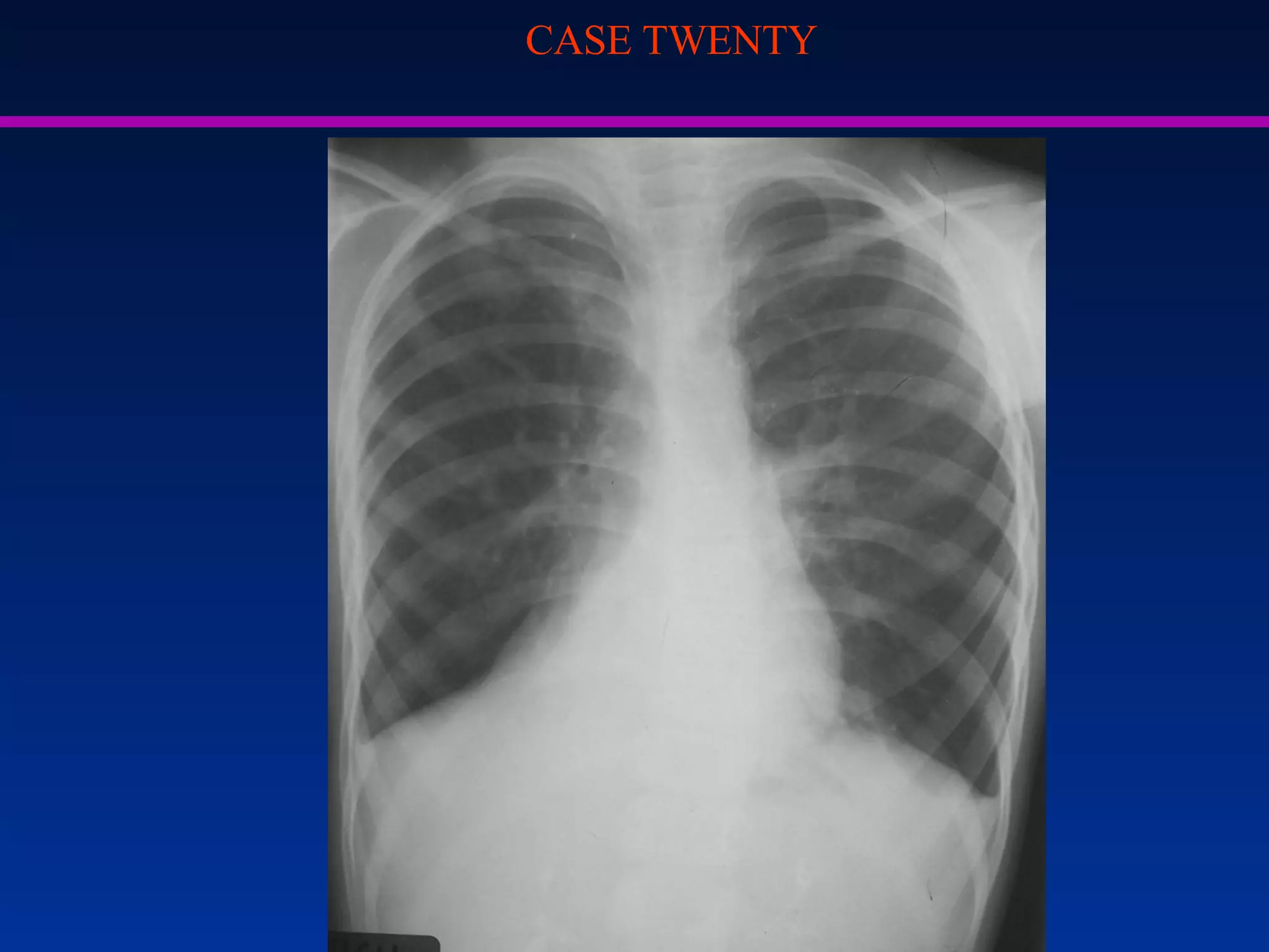 Rapid Reporting Segment 1 | PPT