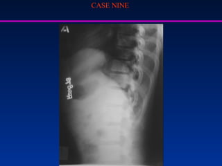 Rapid Reporting Segment 1 | PPT