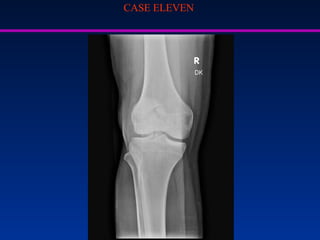 Rapid Reporting Segment 1 | PPT