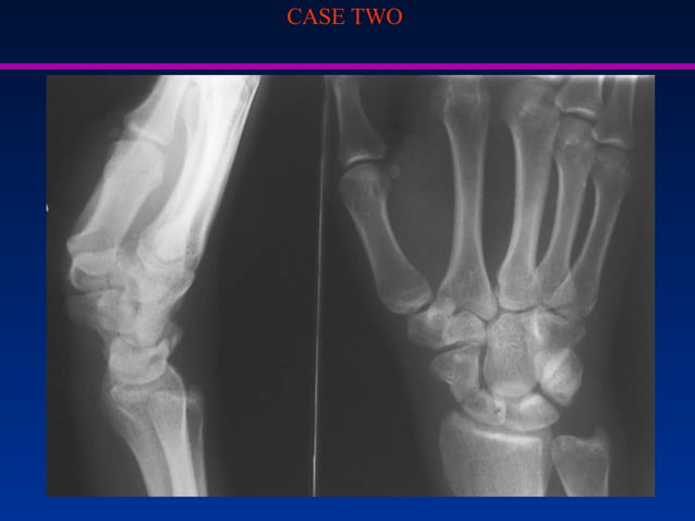 Rapid Reporting Segment 1 | PPT