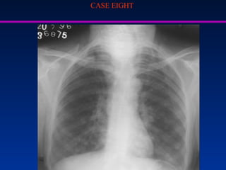 Rapid Reporting Segment 1 | PPT