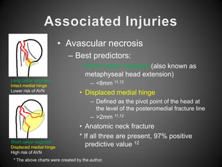 Copy-proximal-humeral-fractures---shin.pdf