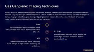 Microbiology infectious disease gas gangrene | PDF