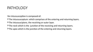 INTUSSUSCEPTION lecture for medical students.pptx