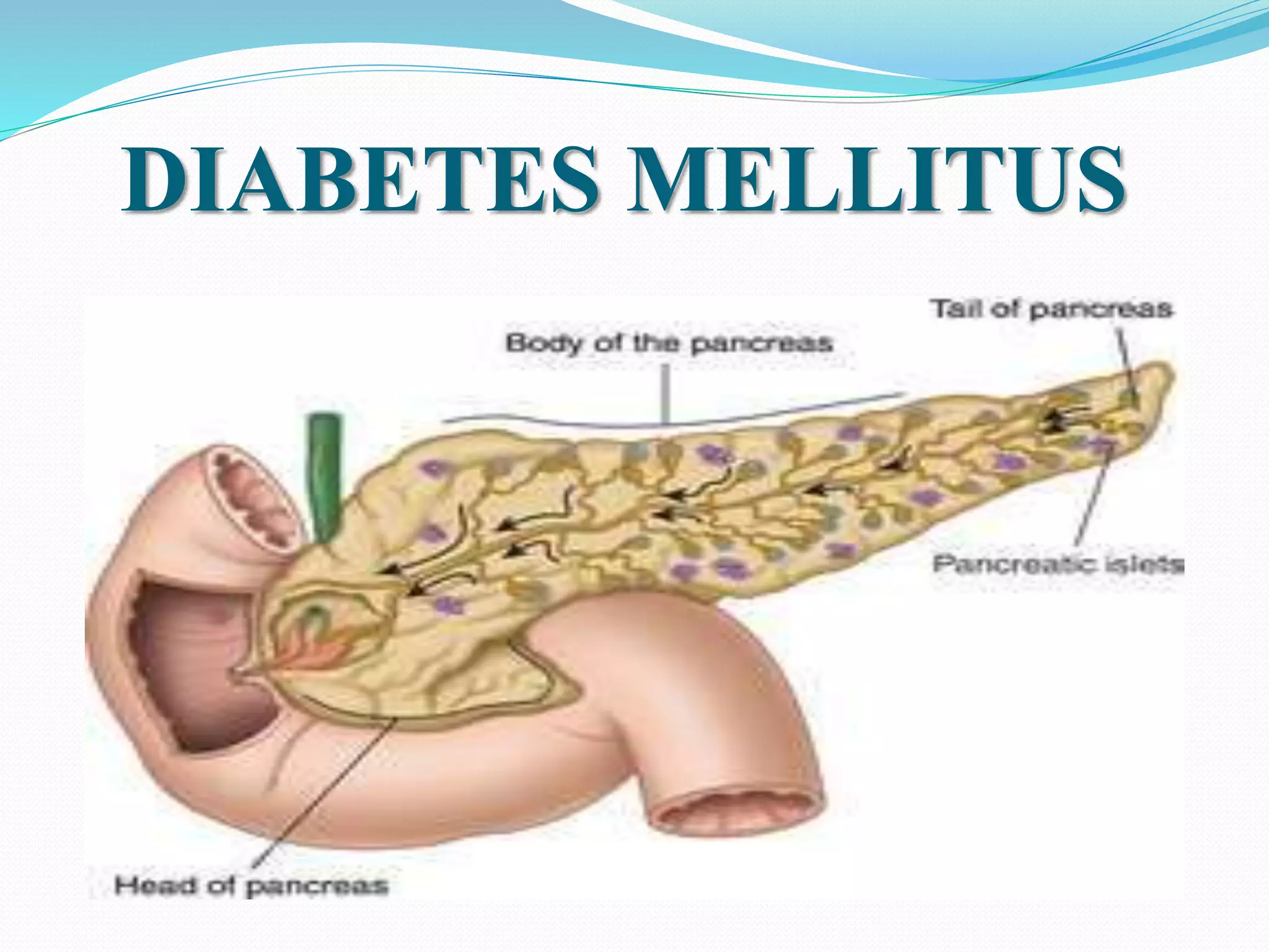 diabetes mellitus presentation | PPTX
