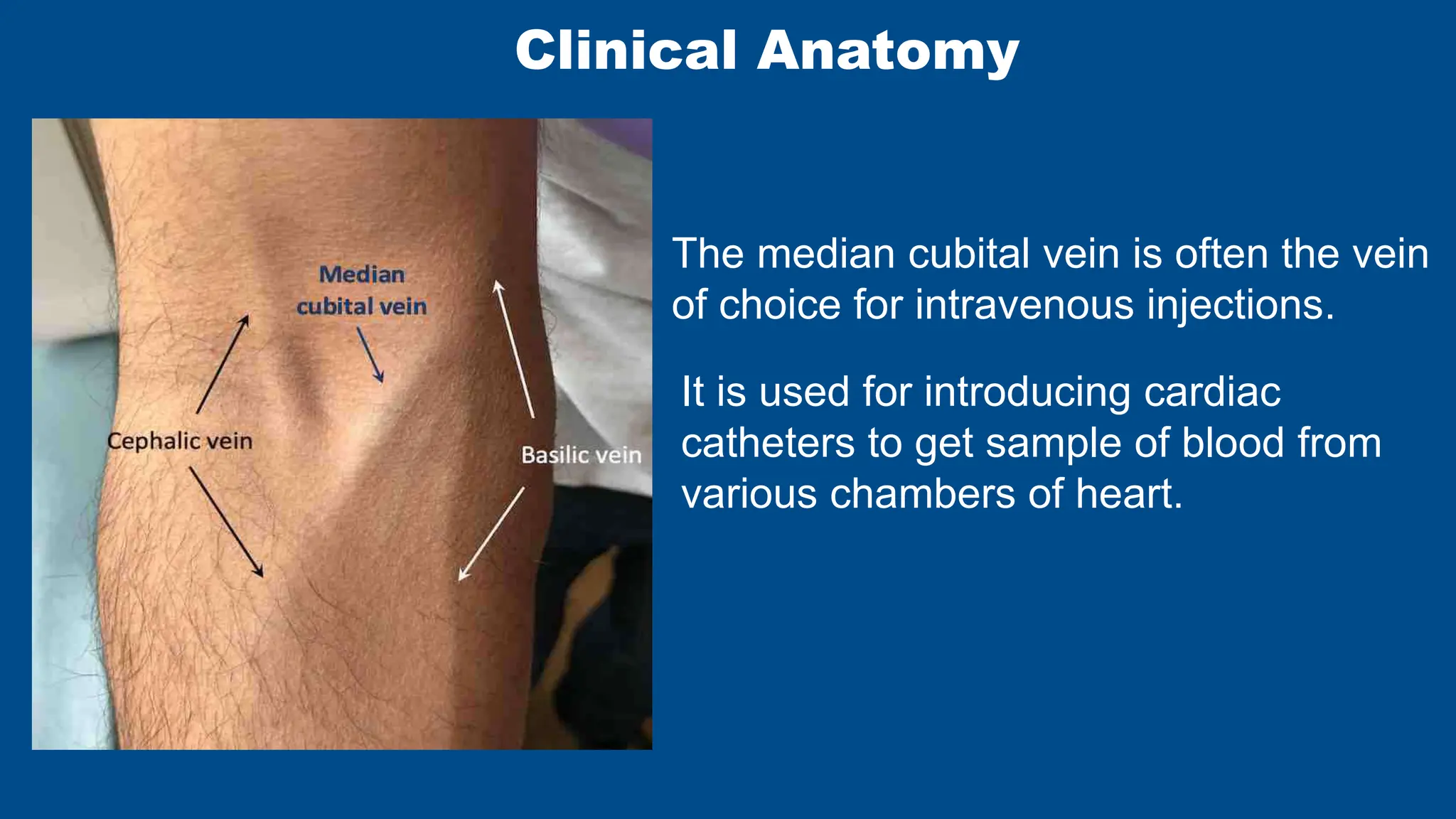 Copy2-Kushagra-220101005 (Cubital Fossa).pptx