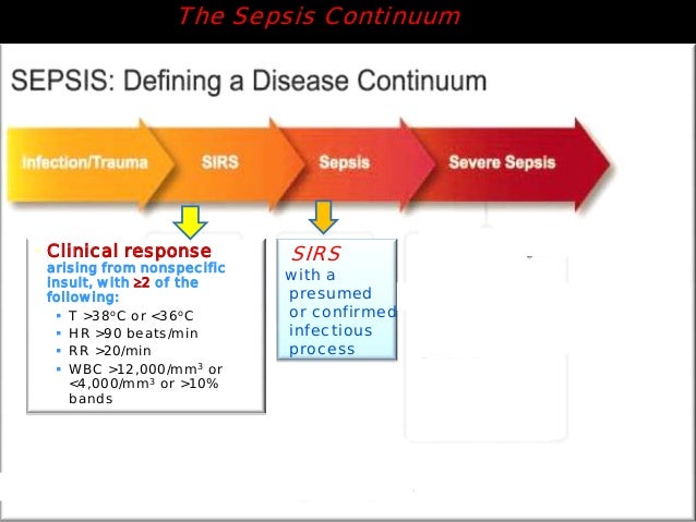 Copy (2) of sepsis present เซกา revised