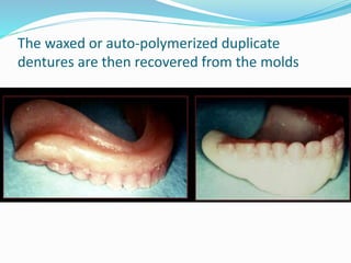 Copy denture | PPTX