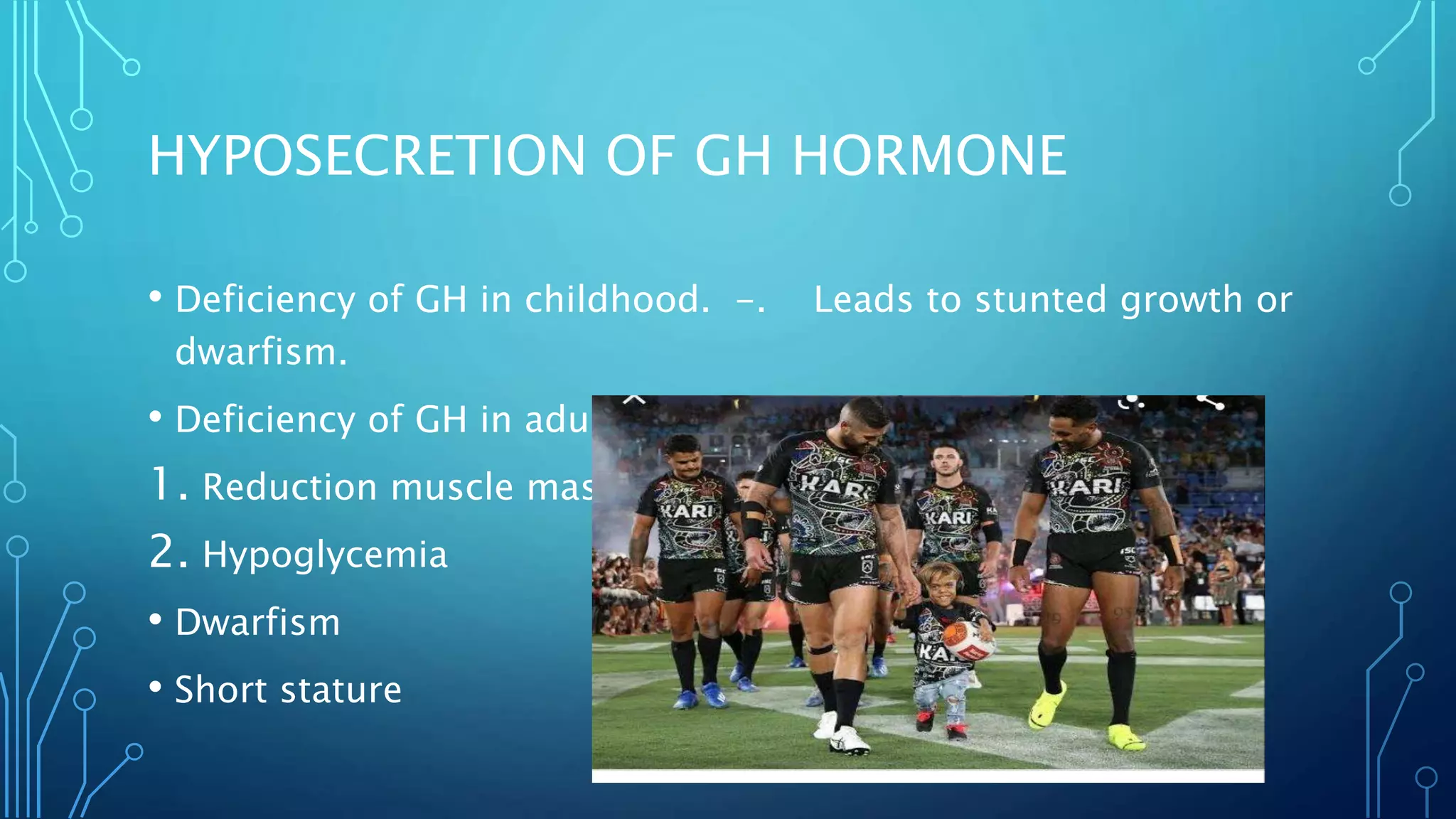 Copy of abnormalities of GH hormone | PPTX