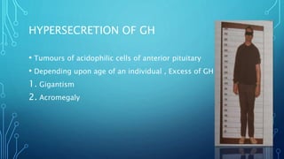 Copy of abnormalities of GH hormone | PPTX