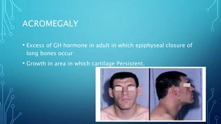 Copy of abnormalities of GH hormone | PPTX