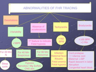 Copy of ANTENATAL FETAL MONITORING-Hatem.ppt